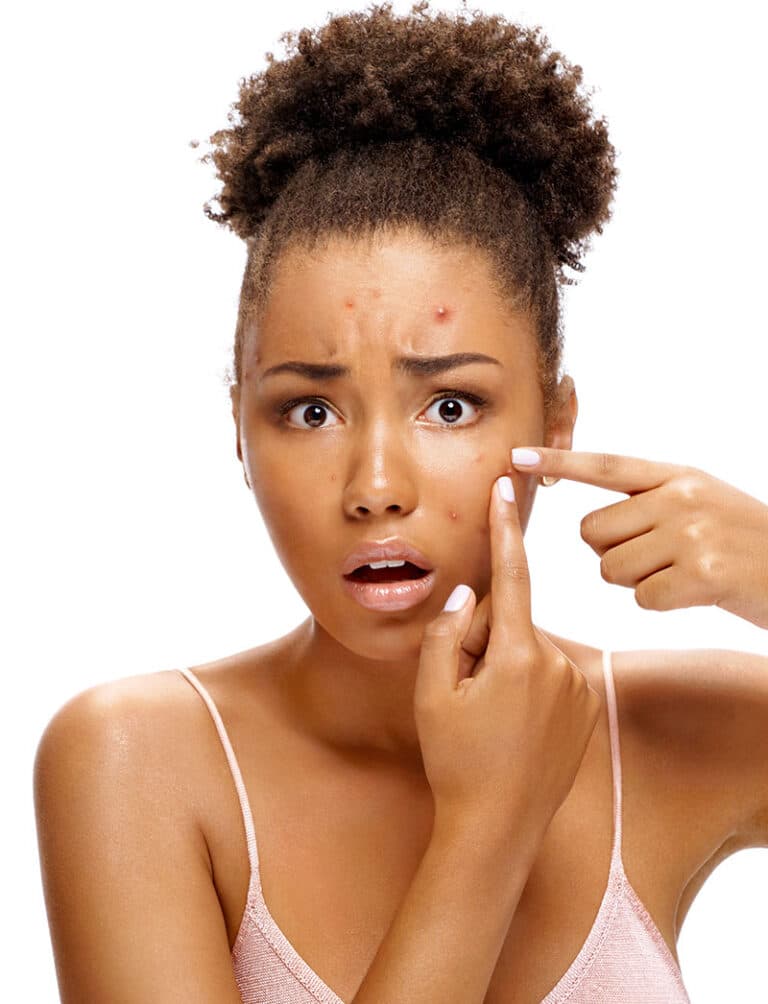 Supermodels with Acne: Dealing with Imperfections